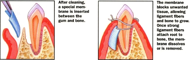 Polk Periodontics Dental Implant Center